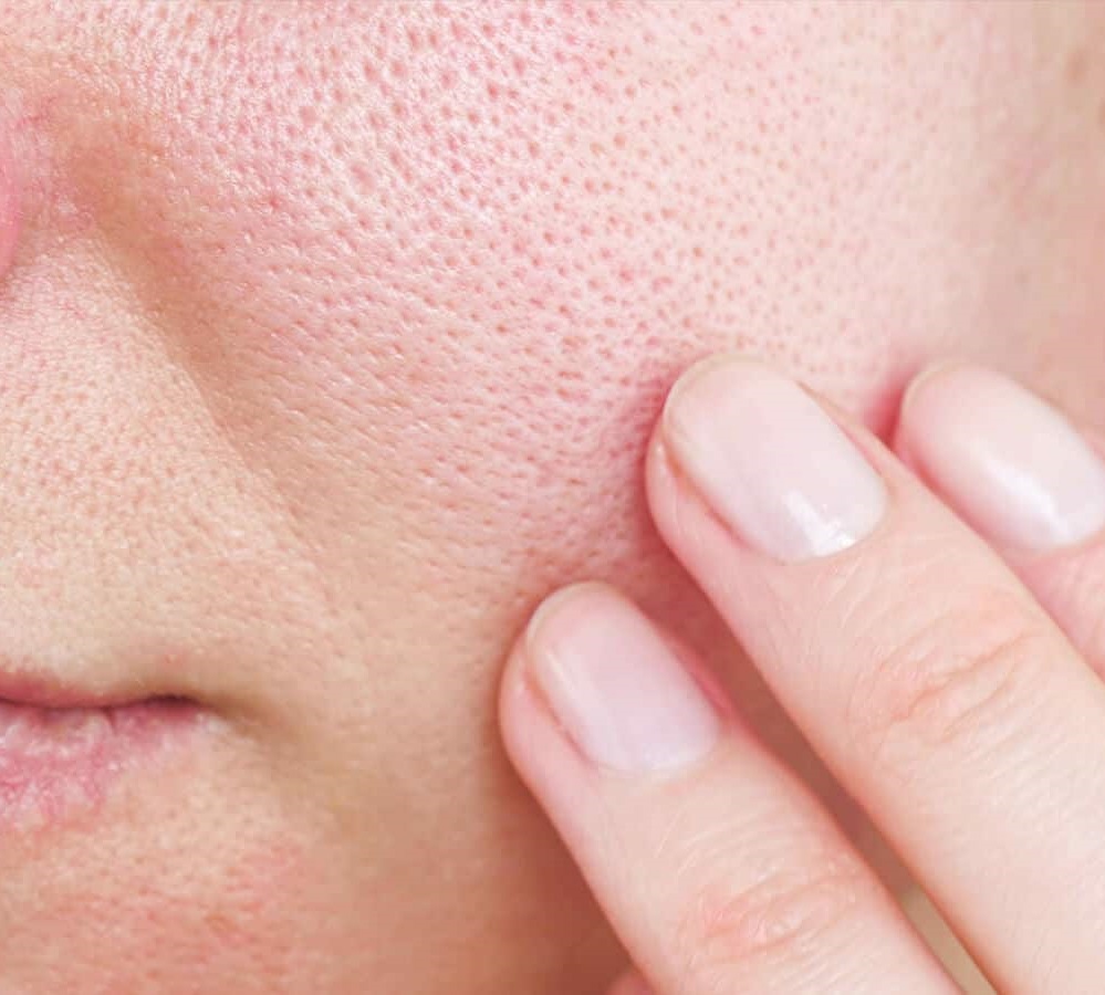 Expert Anti-Aging & Cosmetic Skin Care Treatments | Derma