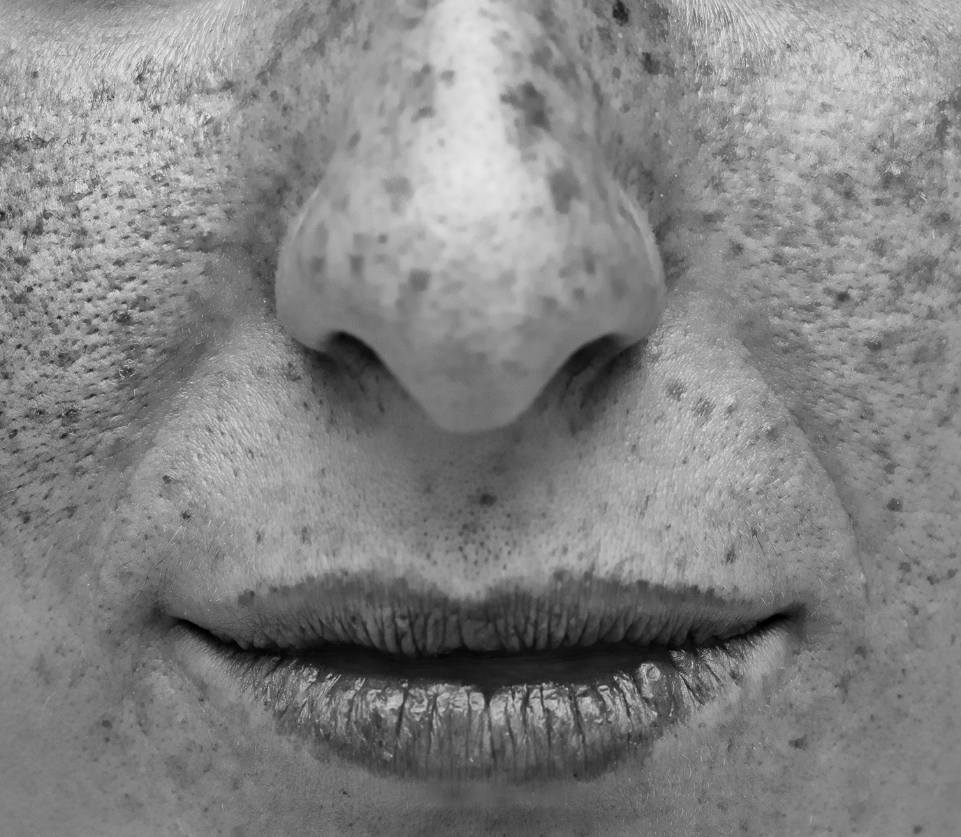 Expert Anti-Aging & Cosmetic Skin Care Treatments | Derma
