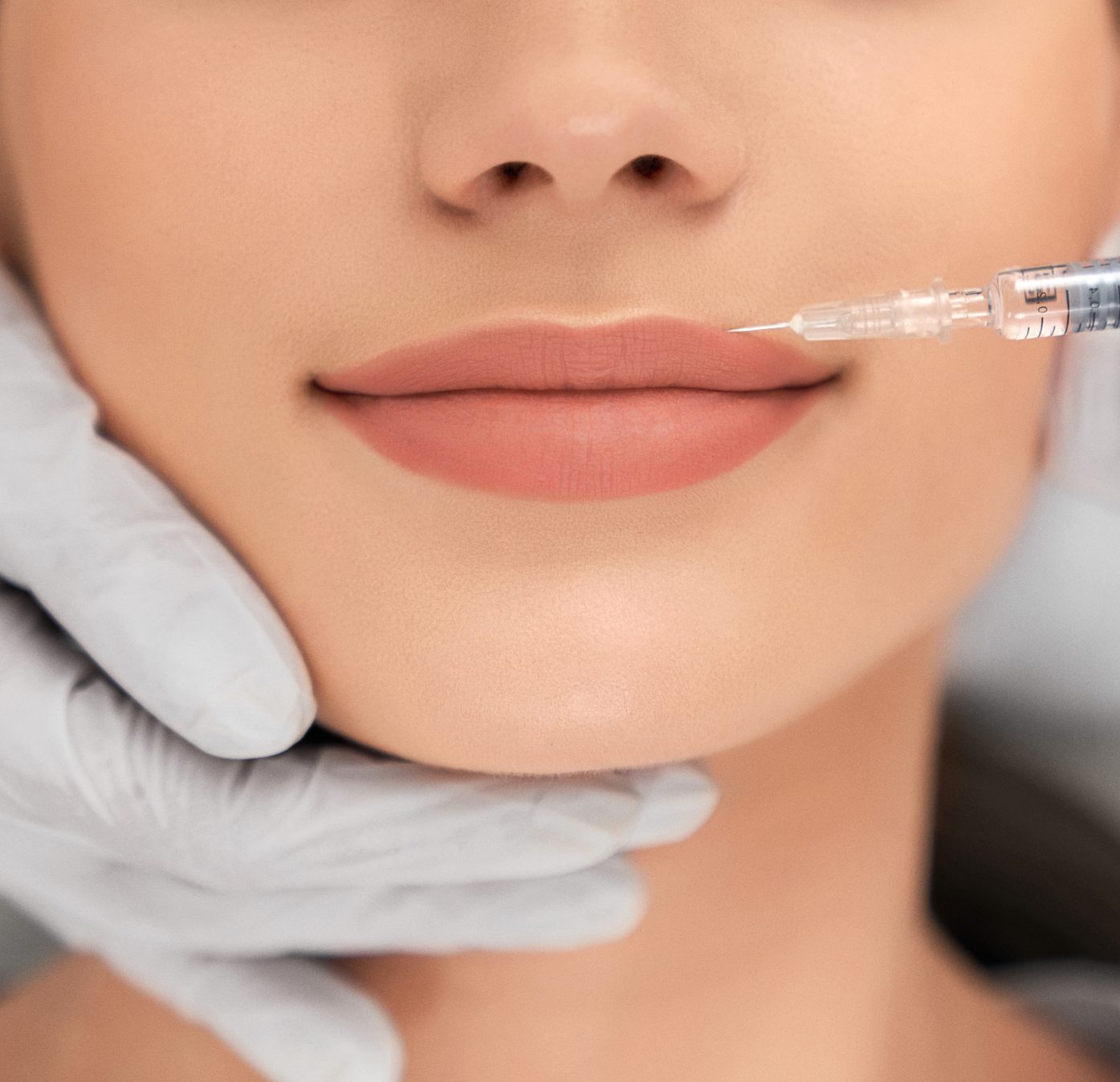 Revive Your Skin in 1-2 Sessions With Dermal Fillers | Derma